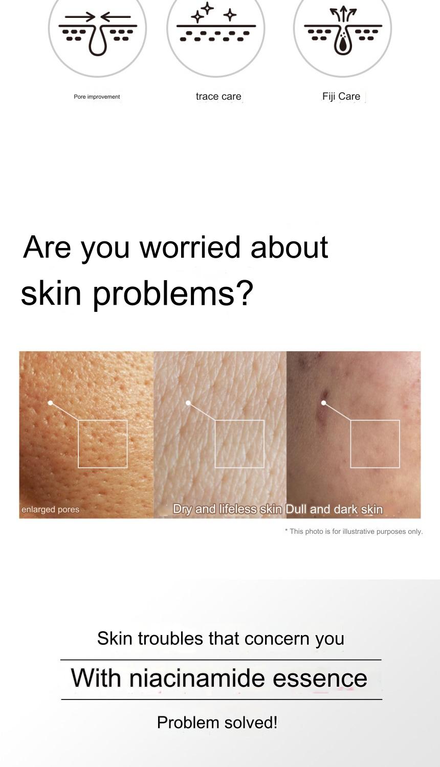 Wati For Skin Made in Korea Niacinamide Perfect Spot Brightening ...