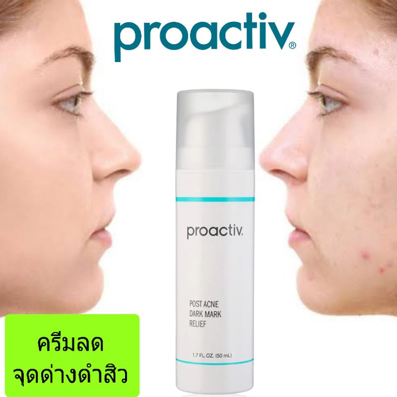 Proactiv Post Acne Dark Mask Relief โปรแอคทีฟ ครีมลดจุดด่างดำ จุดด่างดำ ...