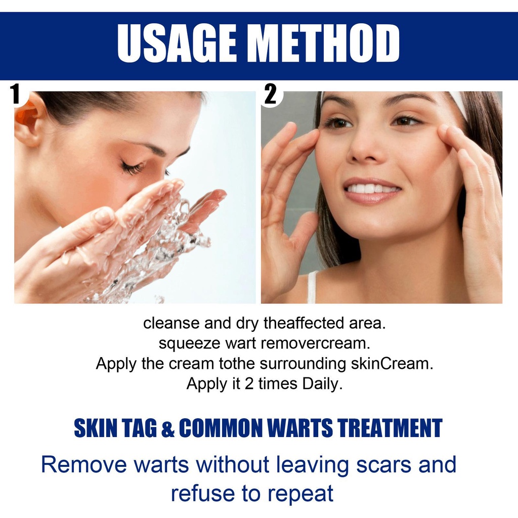 EELHOEครีมกำจัดฉลากผิวหนังเพื่อขจัดหูดข้าวโพด | Shopee Thailand