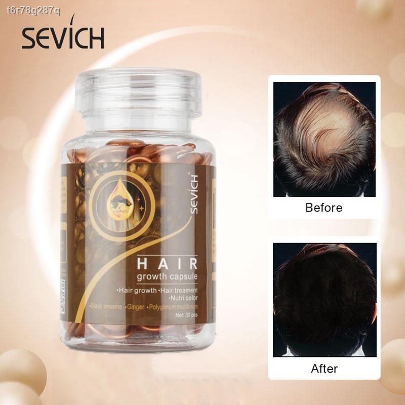 SEVICH Hair Growth Serum Anti-hair Loss Hair Vitamin 30 Capsules ...