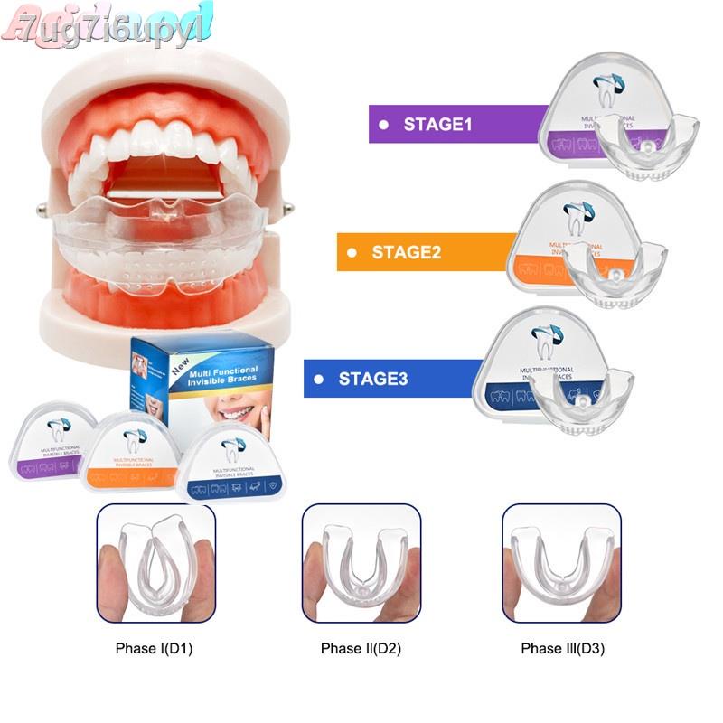 Dental Braces Orthodontic Teeth Trainer Set for Adults Orthotics Tooth ...