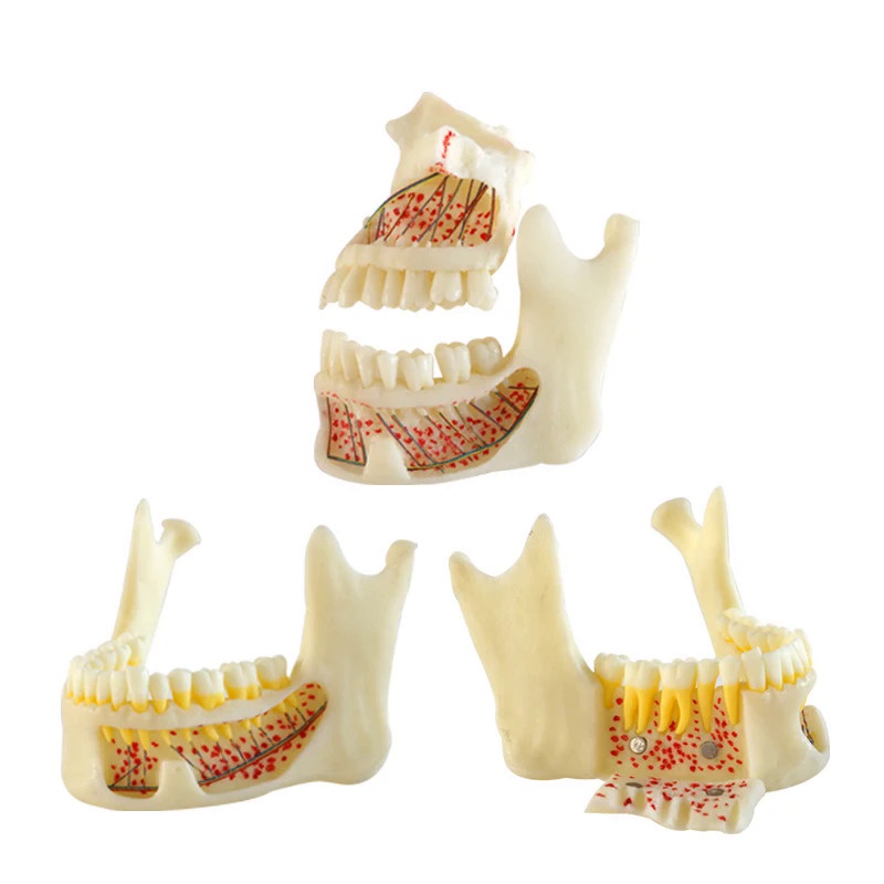 Anatomic Mandible Model Mandible with Hinge Buccal Dentist Student ...