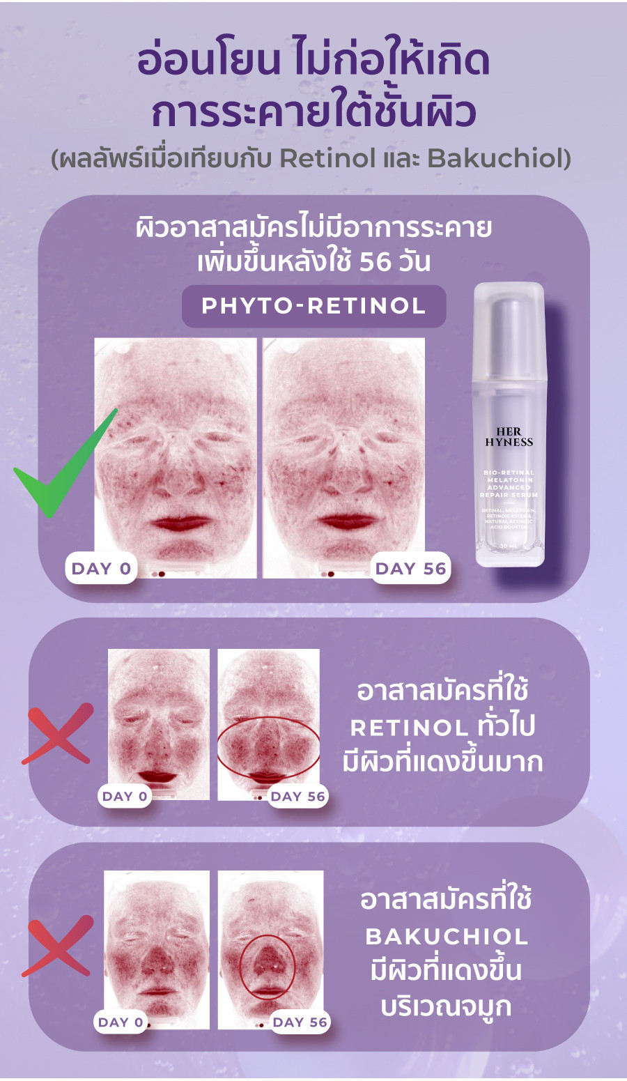 HER HYNESS BIO-RETINAL MELATONIN ADVANCED REPAIR SERUM 30 ML ไบโอ-เรติ ...