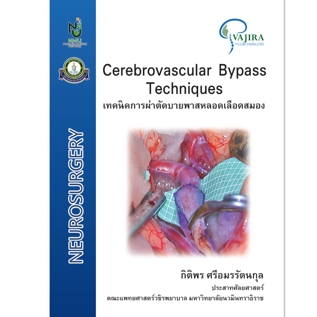 เทคนิคการผ่าตัดบายพาสหลอดเลือดสมอง Cerebrovascular Bypass Techniques | Shopee Thailand