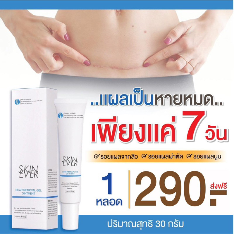 ครีมทารอยแผลเป็น คีรอย(Skin Ever) | Shopee Thailand