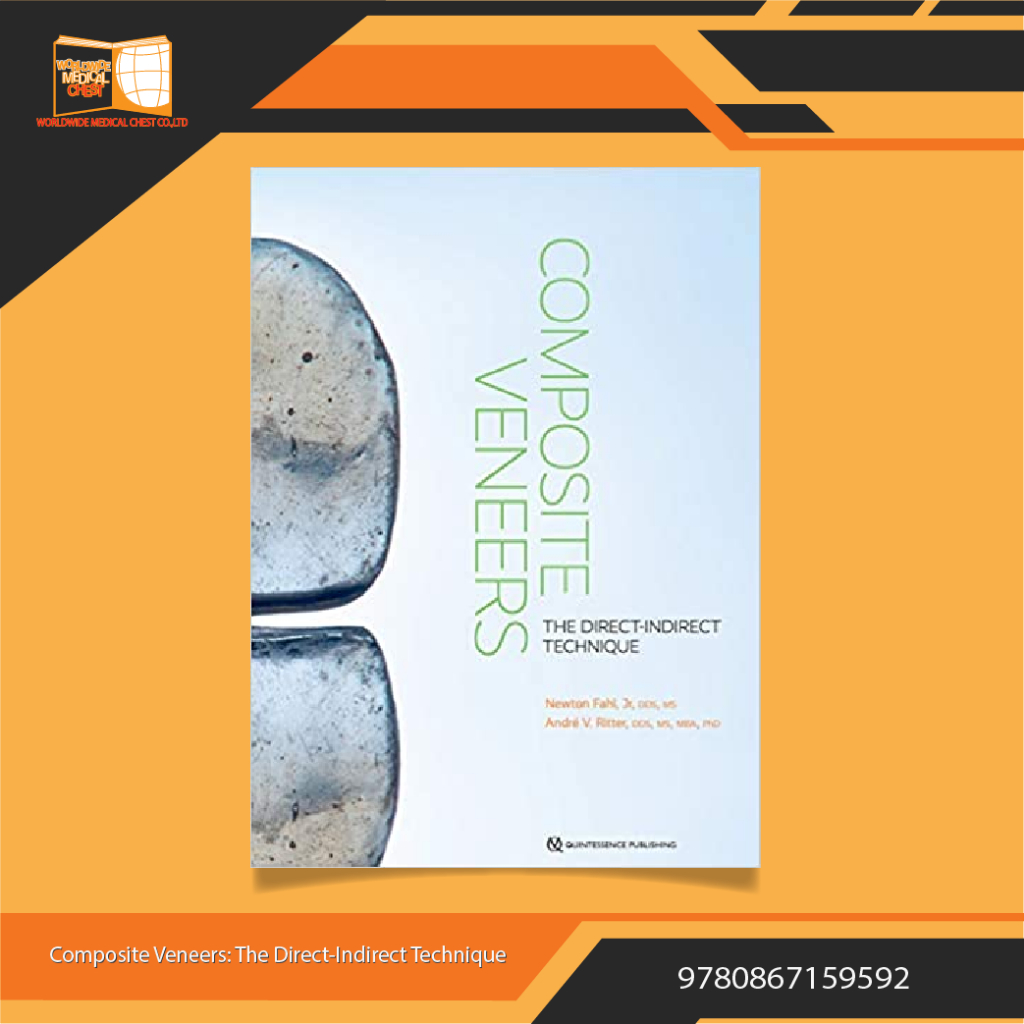 Composite Veneers: The Direct-Indirect Technique 1st Edition | Shopee ...