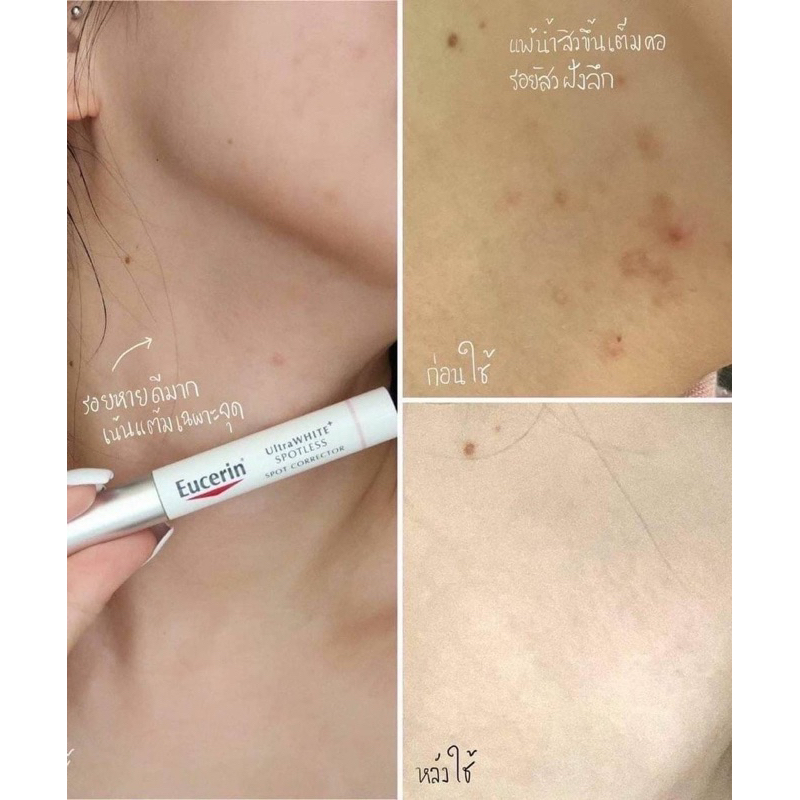 Eucerin UltraWhite Spotless Spot Corrector (5ml) | Shopee Thailand