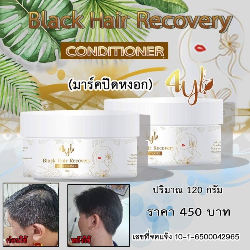 มาร์คปิดหงอกสุดยอดนวัตกรรมใหม่ล่าสุด ของ 4YL Thailand | Shopee Thailand