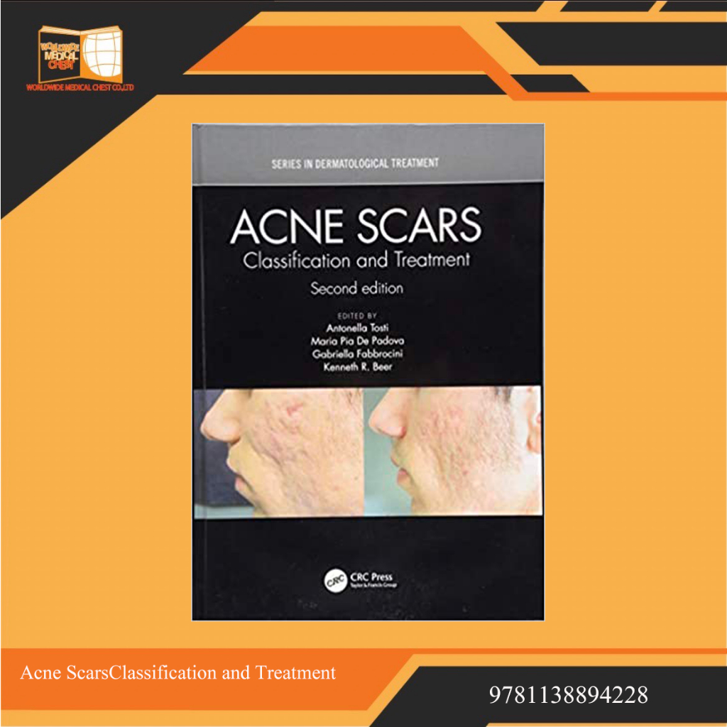 Acne Scars: Classification and Treatment, Second Edition | Shopee Thailand
