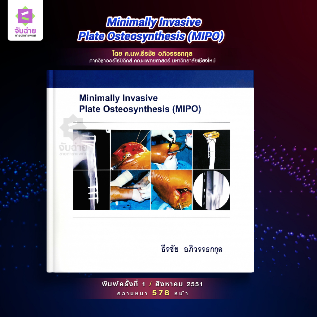 Minimally Invasive Plate Osteosynthesis (MIPO) | Shopee Thailand