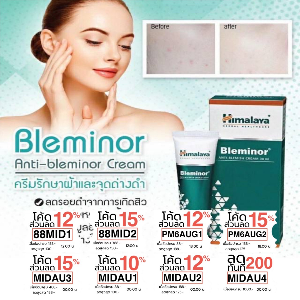 (ซื้อในไลฟ์ 79 บาท)ครีมรักษาฝ้ากะและจุดด่างดำ รอยแกะสิว Himalaya ...