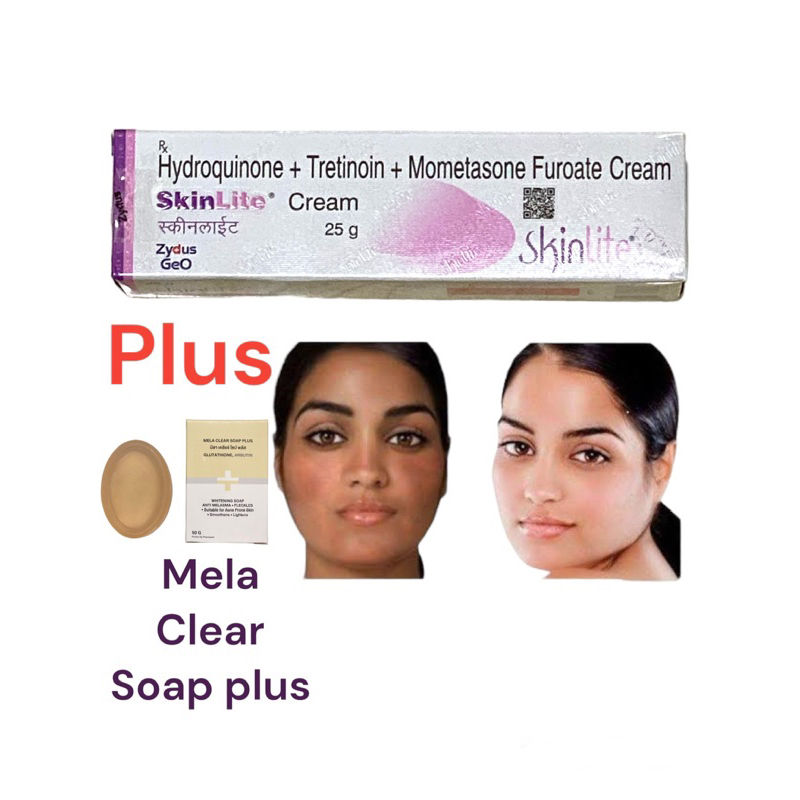 Skinlite 25 G + Mela Clear Soap Plus 50 G ฝ้าจางตั้งแต่สัปดาห์แรก รักษา ...