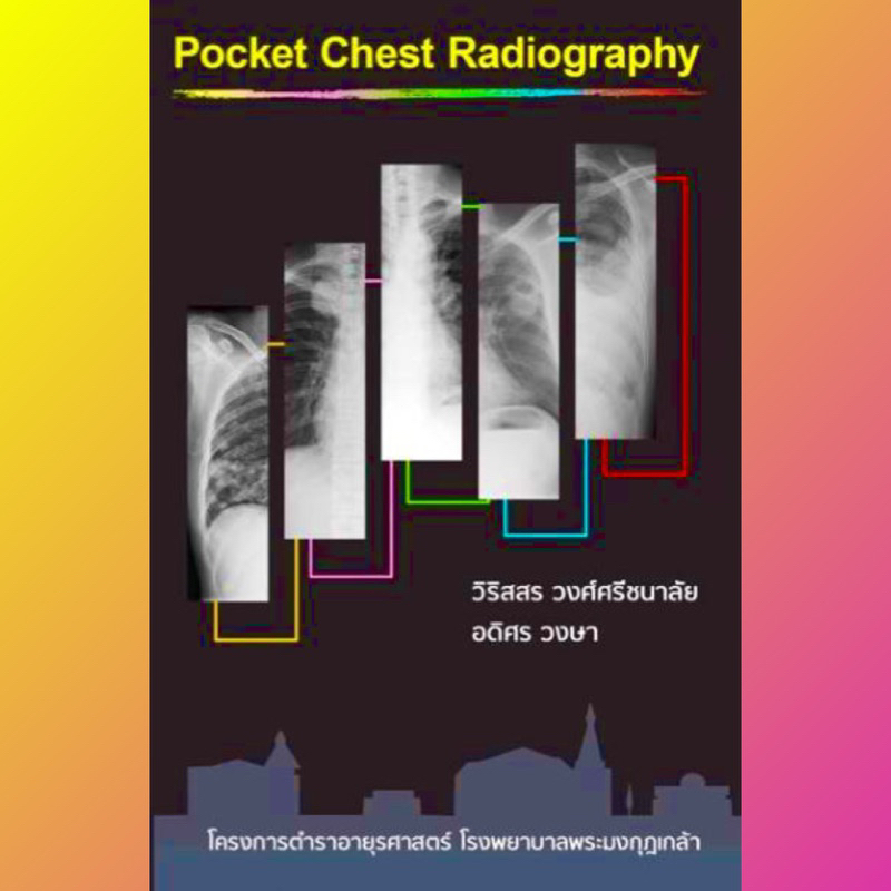 [หนังสือ] Pocket Chest Radiography ตำรา แพทยศาสตร์ รังสีวิทยา อ่านฟิล์ม ...