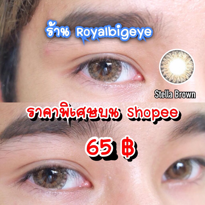 คอนแทคเลนส์ Stella Brown - Kitty Kawaii สีน้ำตาลขนาดตาโต สวยขายดี มี ...