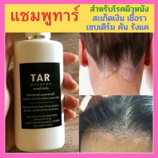 ช้อป tar shampoo ราคาสุดคุ้ม ได้ง่าย ๆ | Shopee Thailand