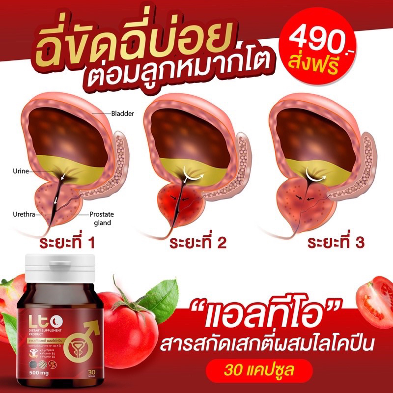LTOปัสสาวะบ่อย ฉี่ขั้ด ฉี่มีกลิ่นเเรง | Shopee Thailand