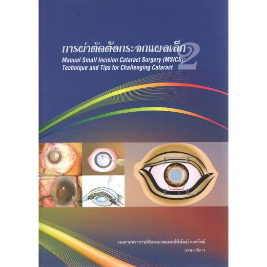 [หนังสือ] การผ่าตัดต้อกระจกแผลเล็ก 2 Manual Small Incision Cataract ...