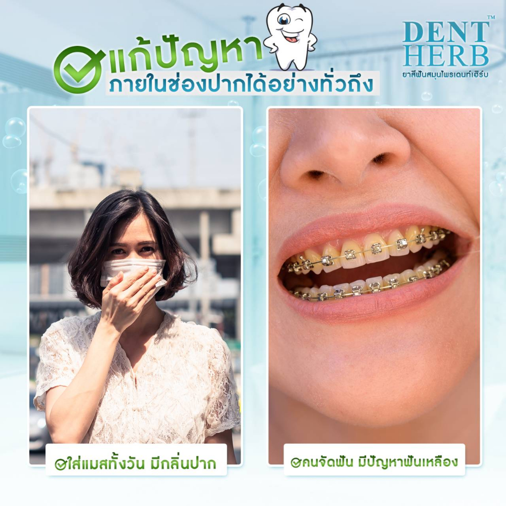 ยาสีฟันเดนท์เฮิร์บ DENT HERB Toothpaste [ 6 หลอด ] (ลดปากเหม็น ลดเสียวฟัน ลดคราบชา กาแฟ เลือดออก ...
