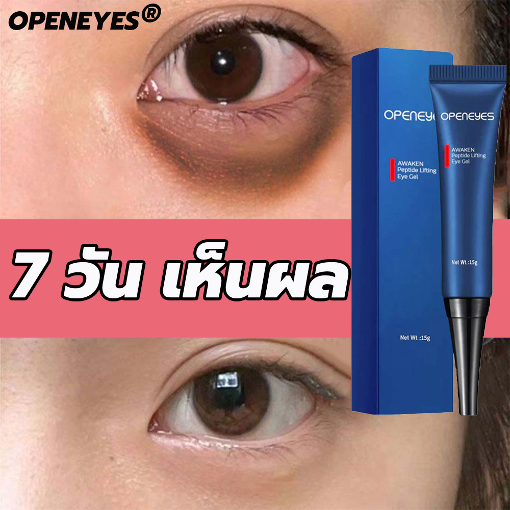 OPENEYES อายครีม 15g Niacinamide ครีมลบถุงใต้ตา กระชับ ยกกระชับ ลดรอยคล้ำใต้ตาลดถุงใต้ตาบวม ...