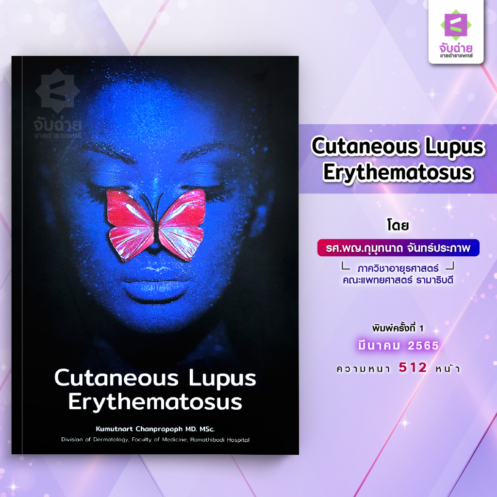 Cutaneous Lupus Erythematosus | Shopee Thailand
