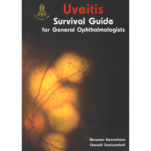 [หนังสือ] Uveitis Survival Guide for General Ophthalmologists โรคม่านตา ...