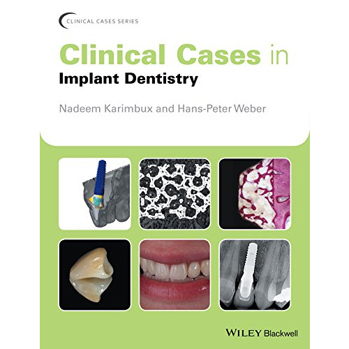 [หนังสือ] Clinical Cases in Implant Dentistry ตำรา ทันตะ ทันตแพทย์ หมอ ...
