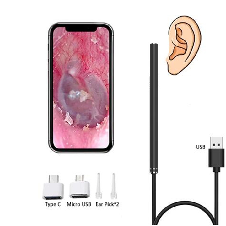 [Intelligent] 3in1 USB Ear Camera พร้อมเครื่องทําความสะอาดหูกล้องขนาด ...