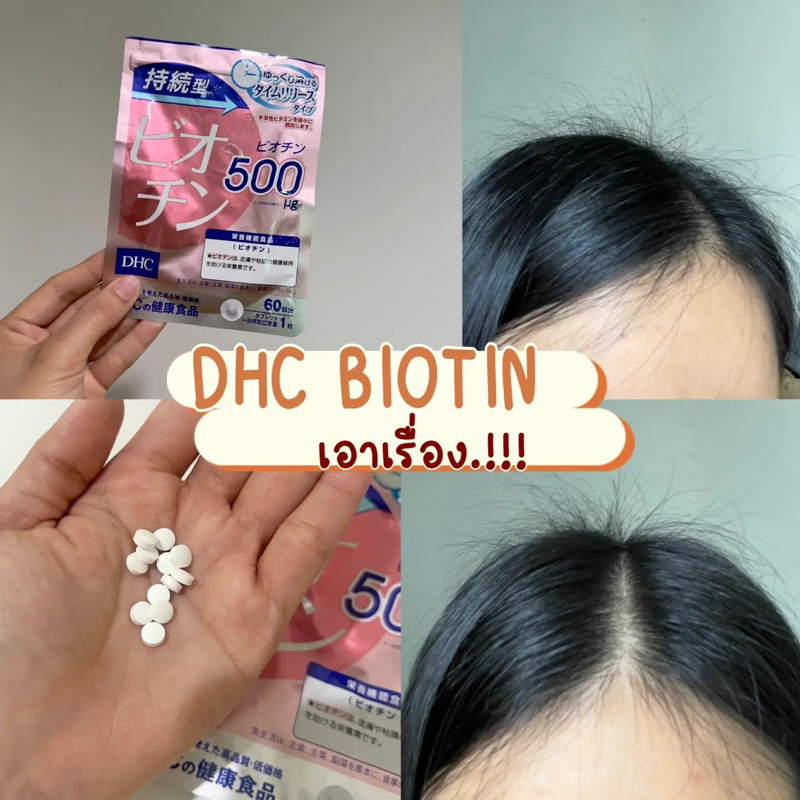 DHC BIOTIN 500mg. แบบ 60วัน | Shopee Thailand