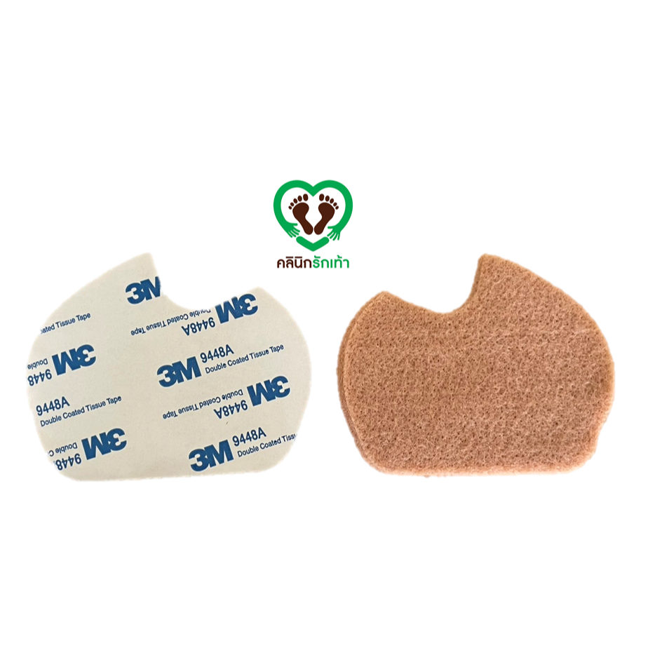 Off-Load pad แผ่นปิดเท้า ใช้เพื่อลดแรงกระแทกบริเวณจมูกเท้า | Shopee ...