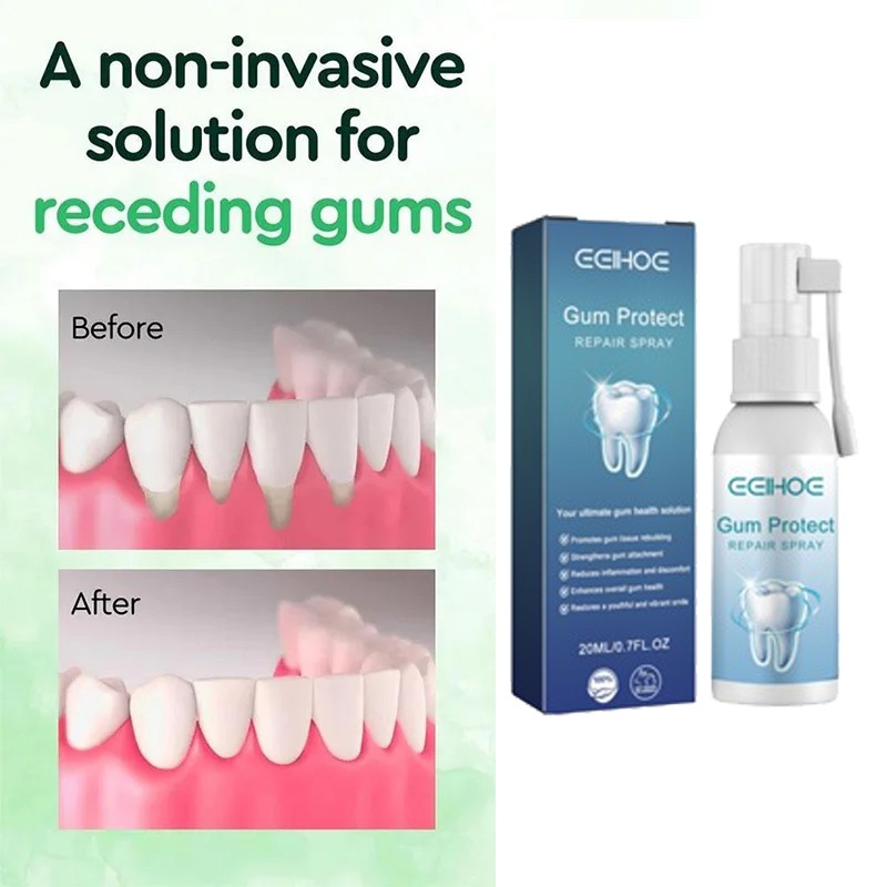 Gum Protect Repair Mouth Spray ดูแลช่องปาก รักษาเหงือก ลดเสียวฟัน ซ่อม ...