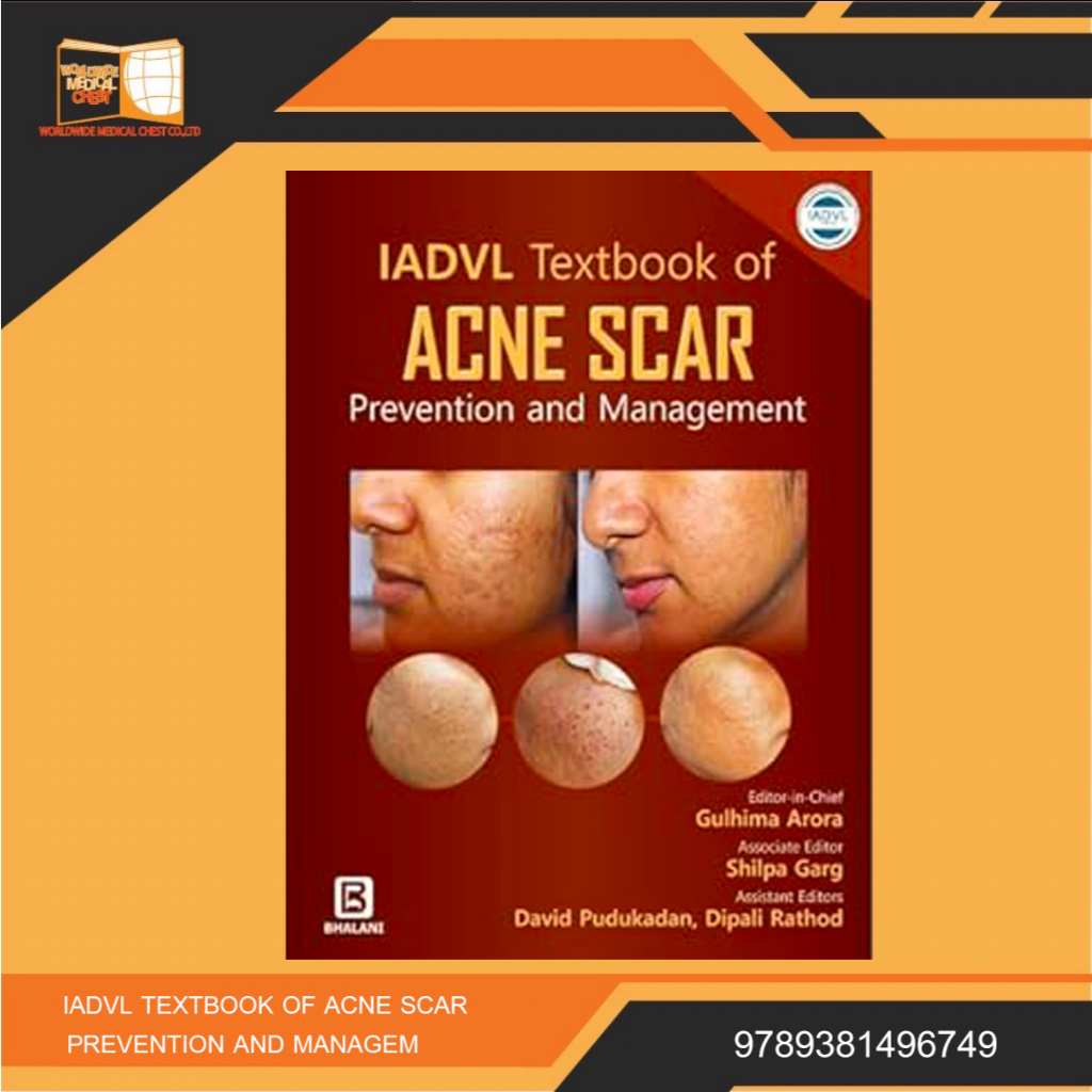 IADVL TEXTBOOK OF ACNE SCAR PREVENTION AND MANAGEM | Shopee Thailand