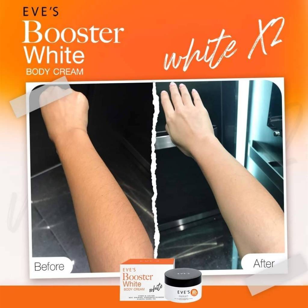EVES บูสเตอร์พลัส ขาวx2 (Limited) ครีมทาท้องลาย คุณแม่ตั้งครรภ์ แตกลายหลังคลอด | Shopee Thailand