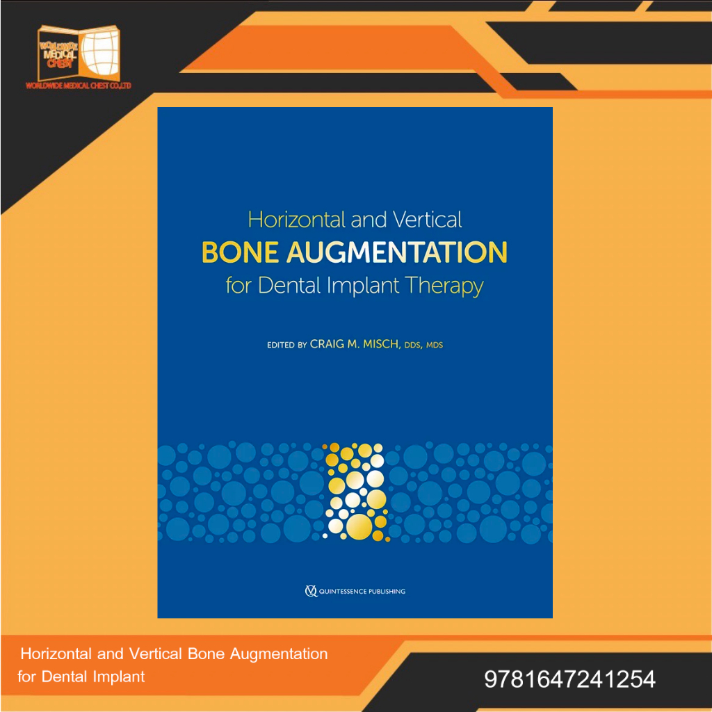 Horizontal and Vertical Bone Augmentation for Dental Implant Therapy ...