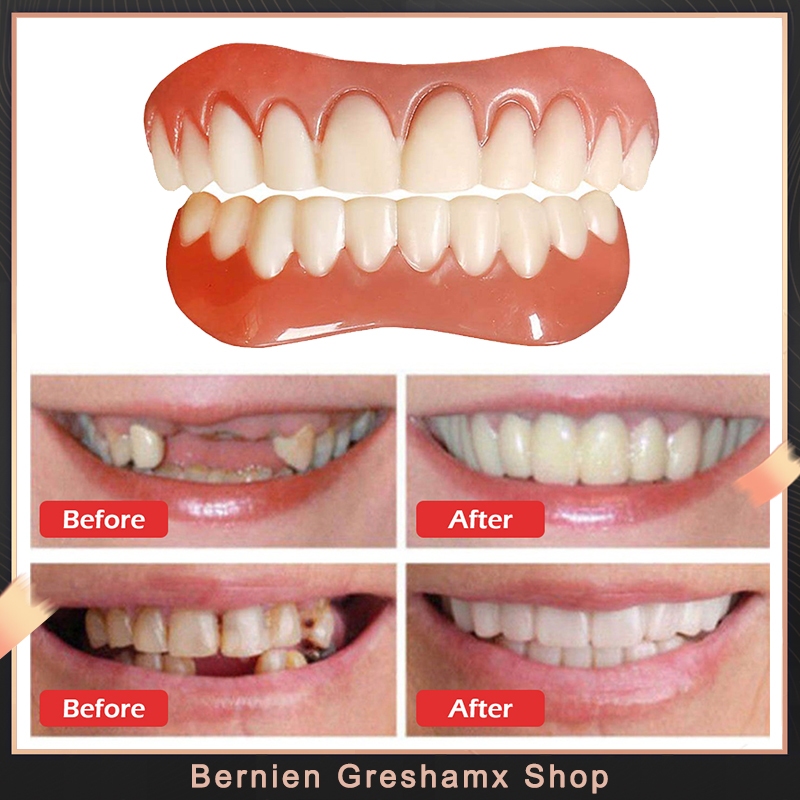 Reusable elderly toothless diet dentures edible dentures imitation ...