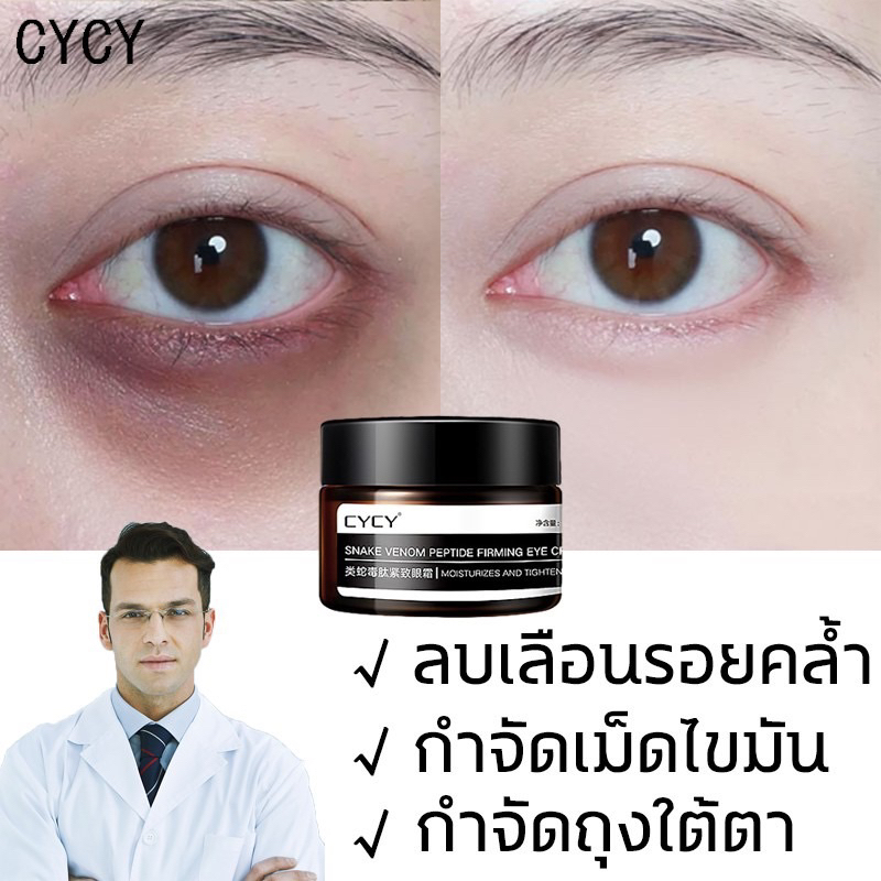 CYCYอายครีม ครีมบำรุงรอบดวงตา30gให้ความชุ่มชื่นขอบตาดำถุงใต้ตารอยตีนกา ...