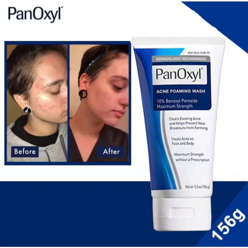 PanOxyl Acne Foaming Wash Benzoyl Peroxide 10% 4% Maximum Strength ...