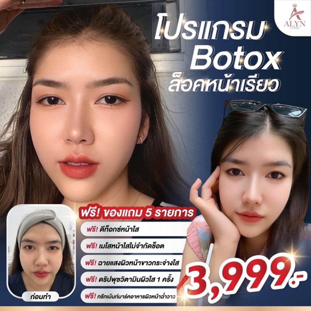[Botox-โบท็อกซ์] โบtox ล็อคหน้าเรียว ของแถม 5 รายการฟรี เพียง 3,999 ...
