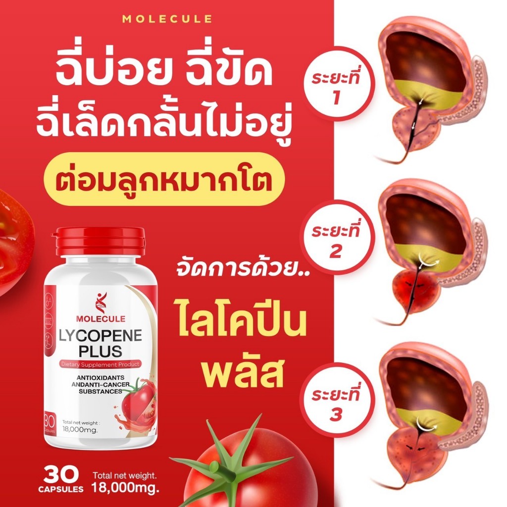 Molecule Lycopene Plus 30 Capsule อาหารเสริมบำรุงต่อมลูกหมาก ไลโคปีน ...