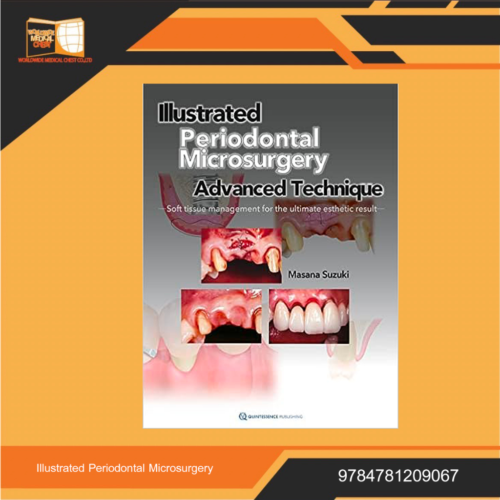 Illustrated Periodontal Microsurgery: Advanced Technique Soft Tissue ...