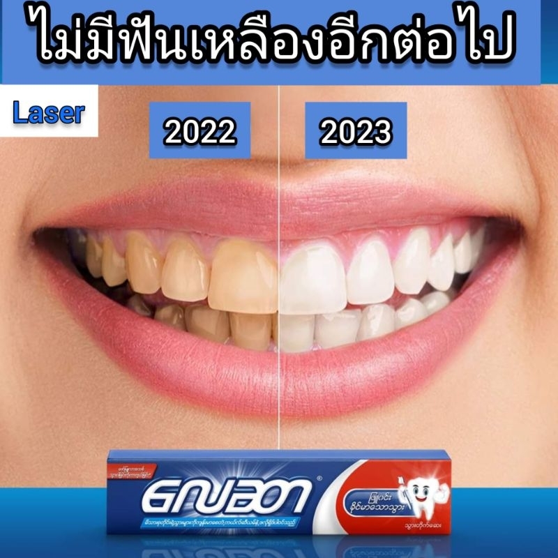 Laser Whitening Toothpaste ยาสีฟัน เลเซอร์ | Shopee Thailand