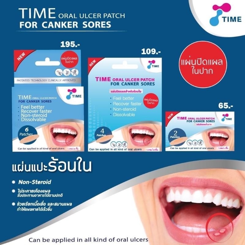 TIME ORAL ULCER PATCH แผ่นแปะแผลร้อนใน | Shopee Thailand