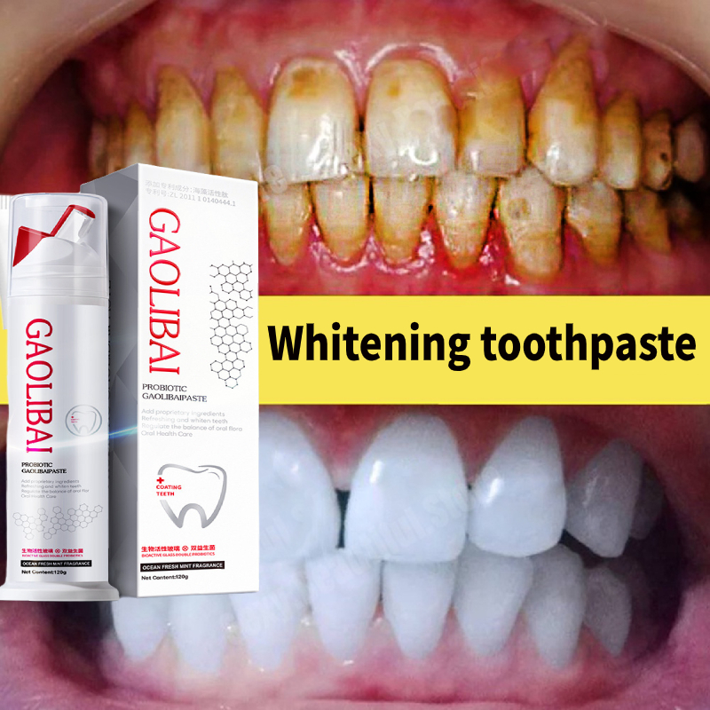 เทคโนโลยีใหม่ปี 2024 GAOLIBAI ฟอกฟัน ขจัดคราบฟันคราบควันคราบกาแฟ เพิ่ม ...