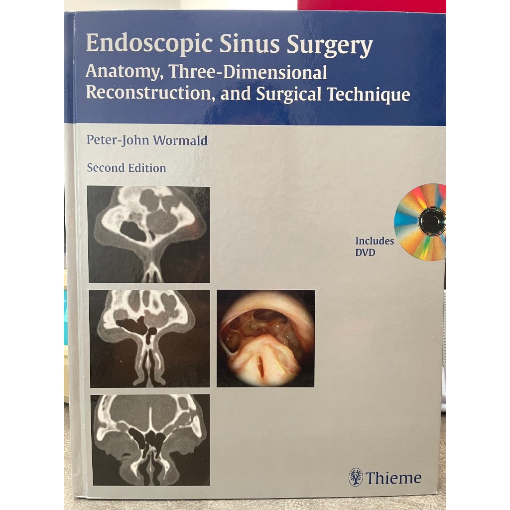 Endoscopic Sinus Surgery: Anatomy, Three-dimensional Reconstruction ...