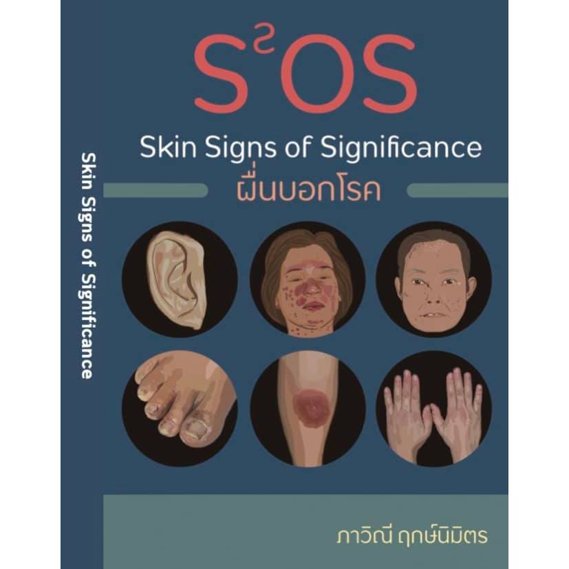 c111 ผื่นบอกโรค (SKIN SIGNS OF SIGNIFICANCE) 9786164077188 | Shopee ...