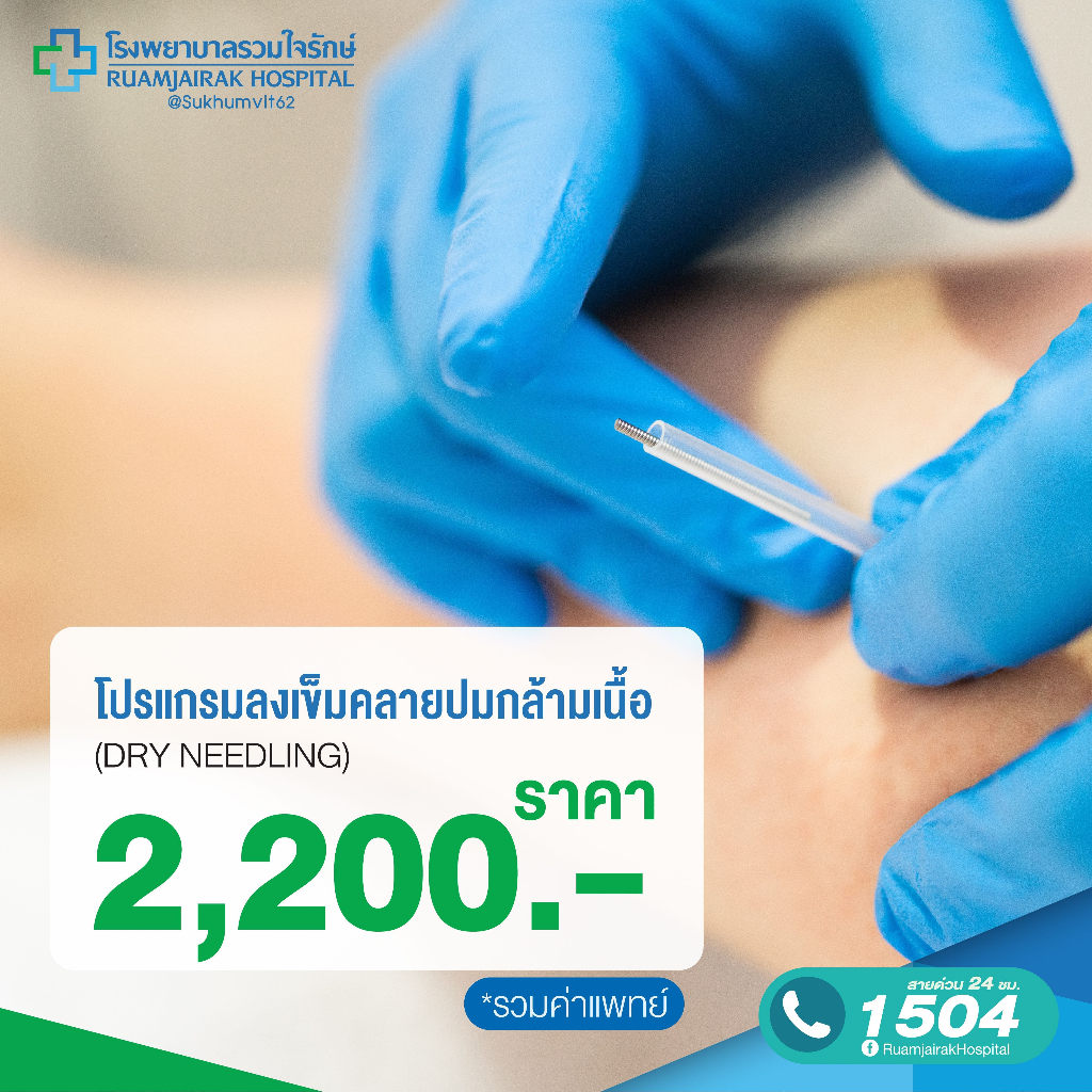 โปรแกรมลงเข็มคลายปมกล้ามเนื้อ (DRY NEEDLING) รวมใจรักษ์ | Shopee Thailand