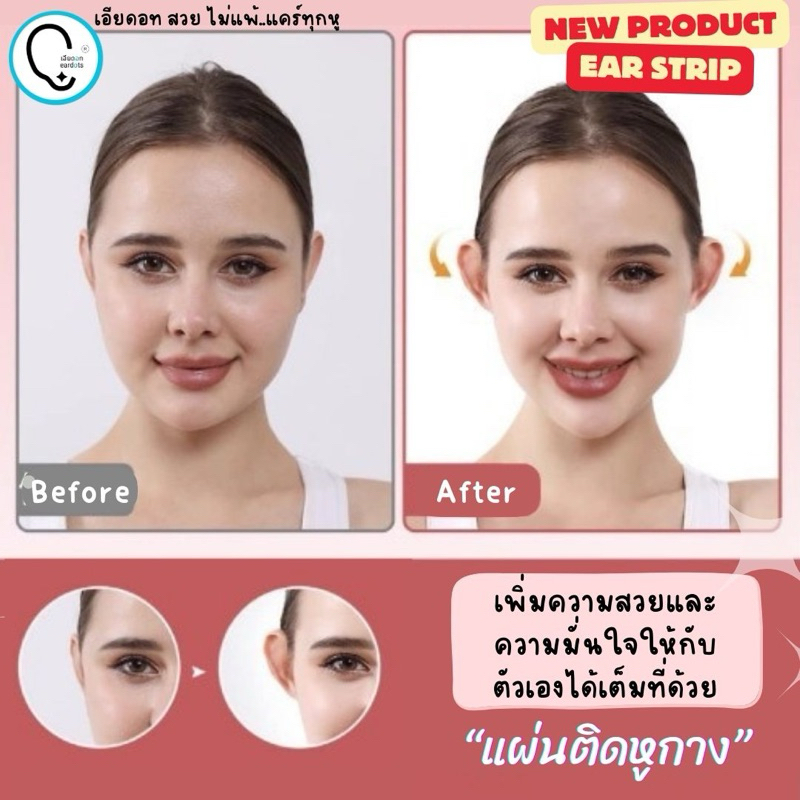 แผ่นติดทำให้หูกางดูมีมิติ ELF EAR STRIPS by eardots | Shopee Thailand