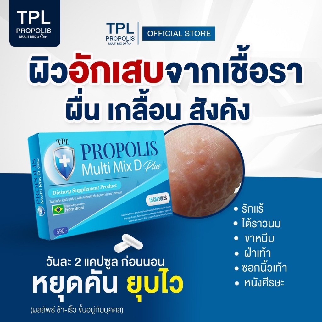 TPL Propolis ทีพีแอล โพรโพลิส วิตามินภูมิแพ้ ผิวหนัง ผิวอักเสบ ผื่นคัน ...