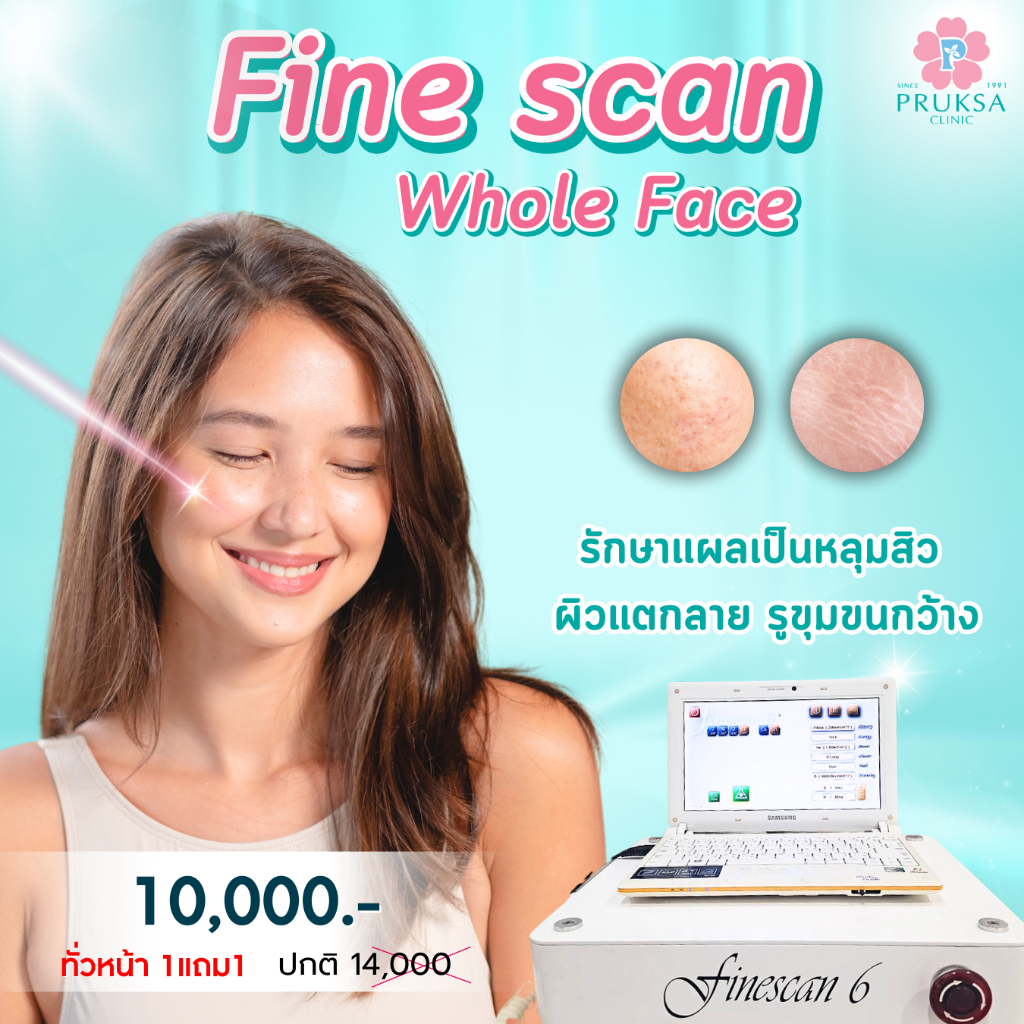 Fine Scan เลเซอร์ผิวหน้า ลดหลุมสิว รูขุมขน ลดผิวแตกลาย 1 แถม 1 | Shopee Thailand