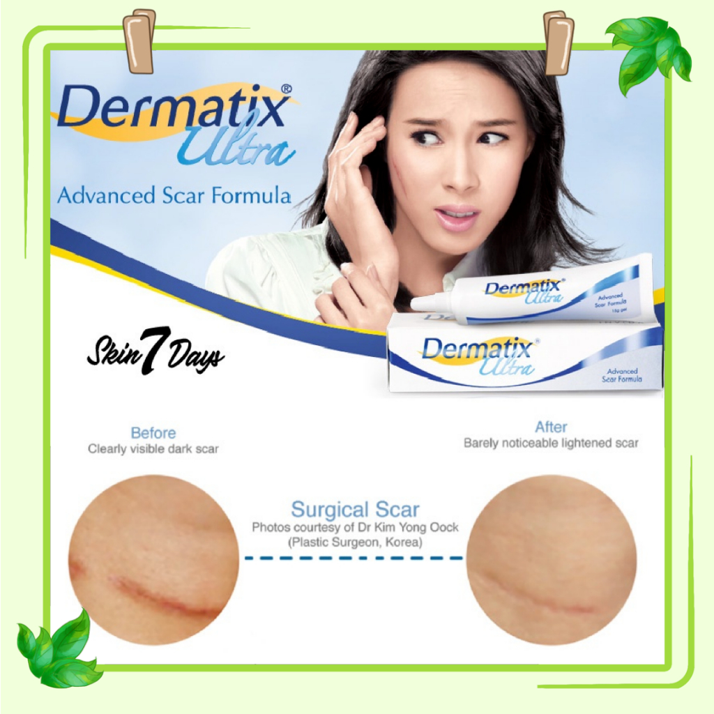 Dermatix Ultra Scar Gel 15g เดอร์มาติก สการ์ ครีม ครีมลบรอยแผลเป็น ...