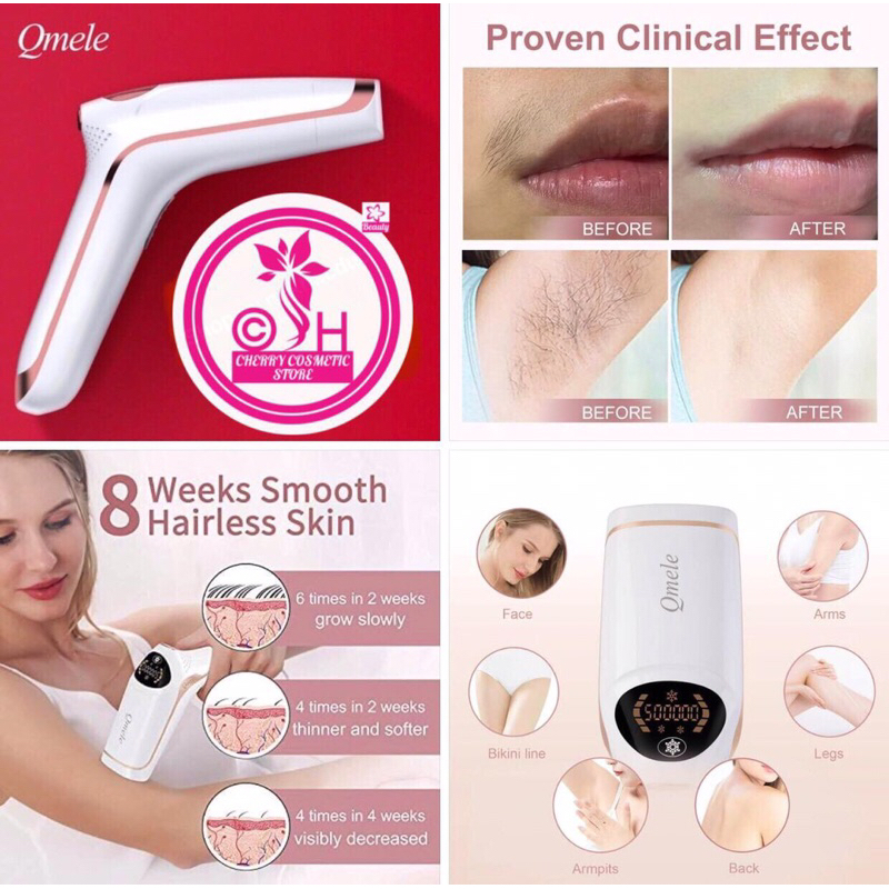 Qmele Ipl machine ( hair removal ) | Shopee Thailand
